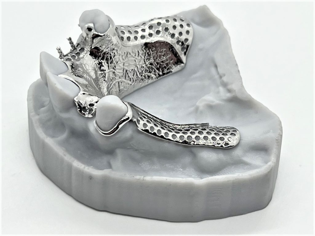 Frame Only With Model – GPS Digital RPD