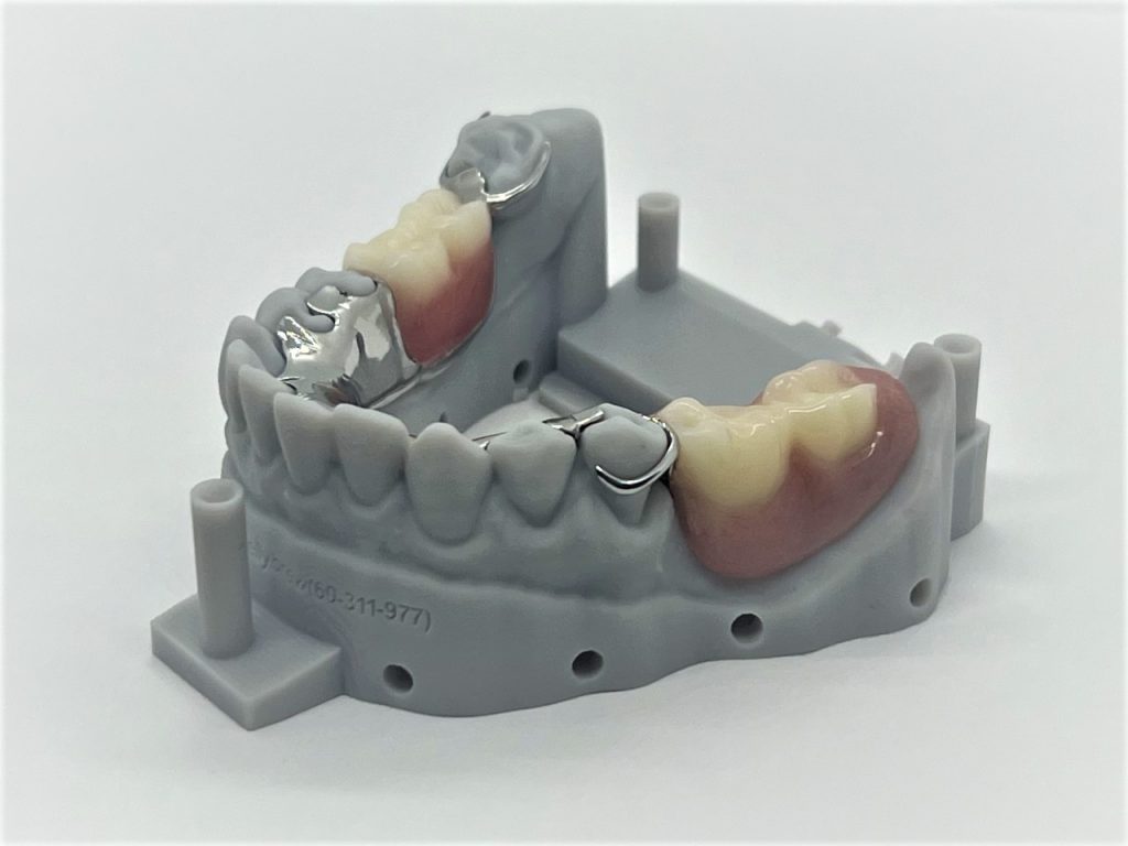 Frame To Finish With Model – GPS Digital RPD