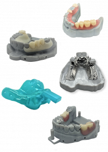 GPS Digital RPD – Your RPD Framework Solution