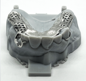 Frame Only With Model From Digital CAD Design – GPS Digital RPD