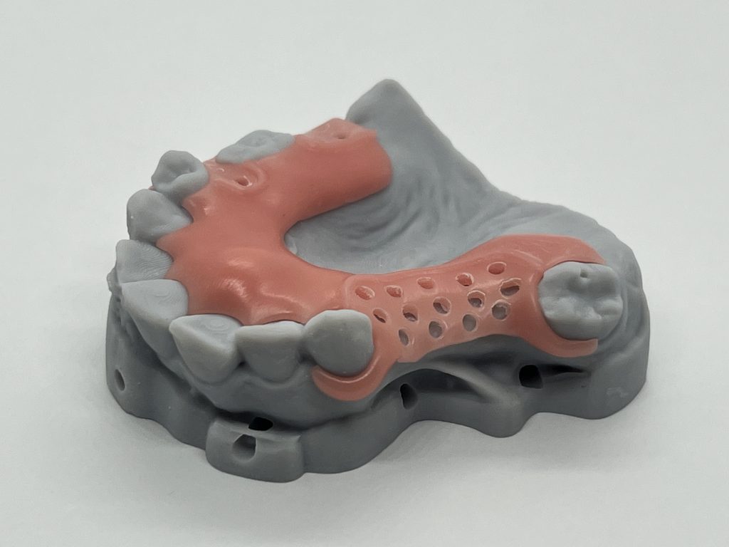 Flexible Partial Frame with Model – GPS Digital RPD