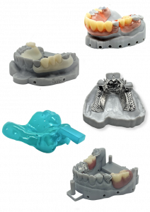 GPS Digital RPD – Your RPD Framework Solution