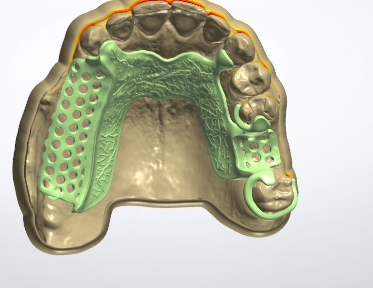 Portfolio – GPS Digital RPD