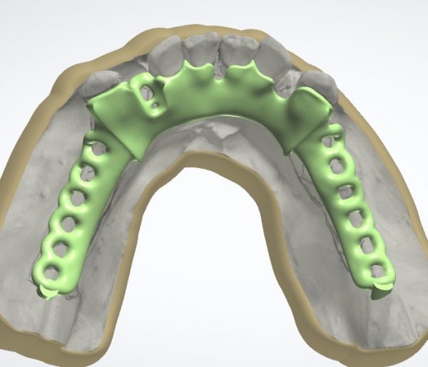 Portfolio – GPS Digital RPD