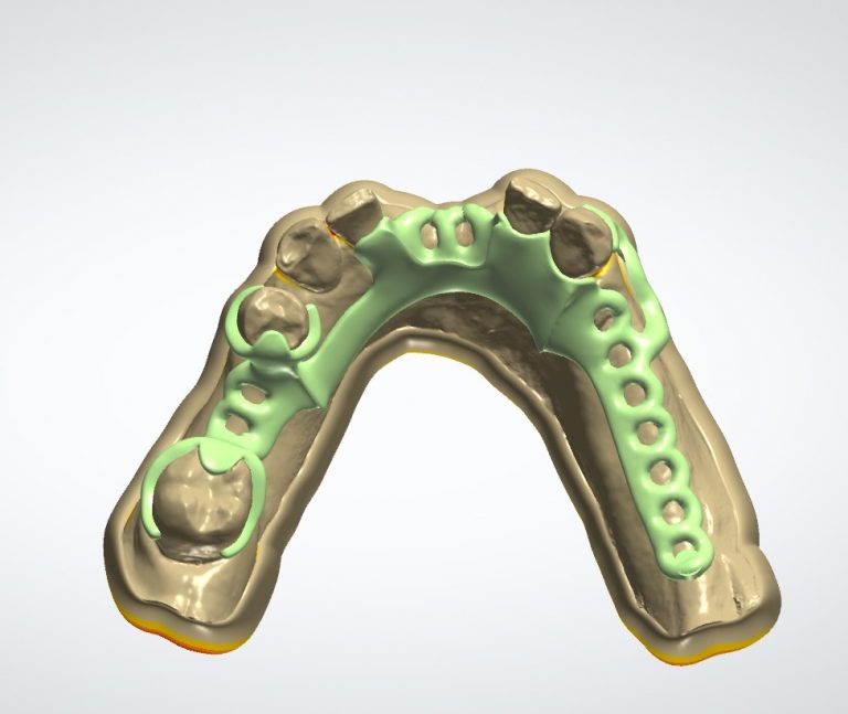 Portfolio – GPS Digital RPD