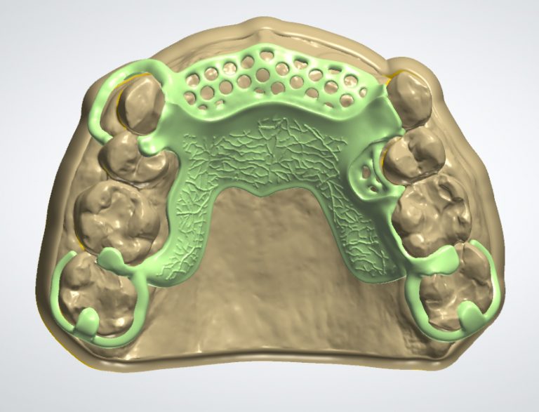 Portfolio – GPS Digital RPD