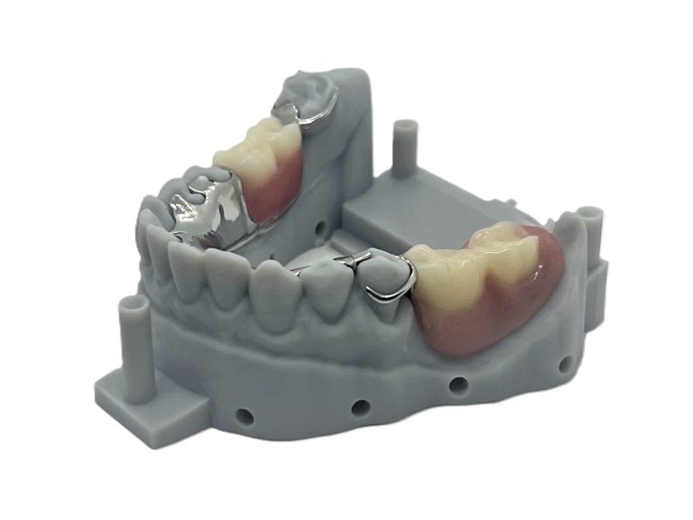 Frame To Finish With Model – GPS Digital RPD